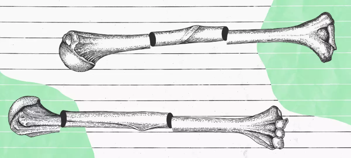 6 dulumtanan sa mga butang nga ang mga tawo nga gihimo uban kanila tungod sa siyensiya 18585_2