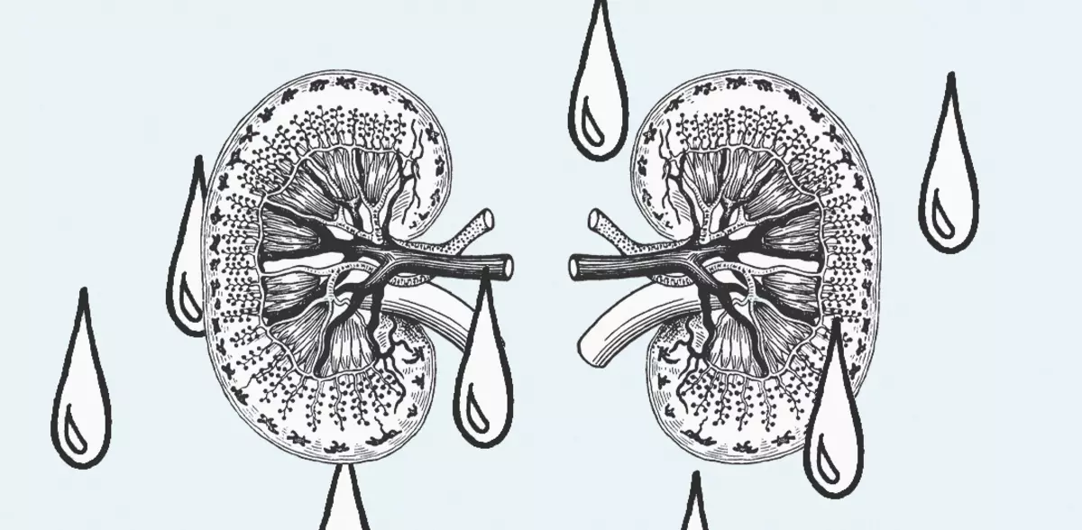 17 semne că aveți probleme cu rinichii